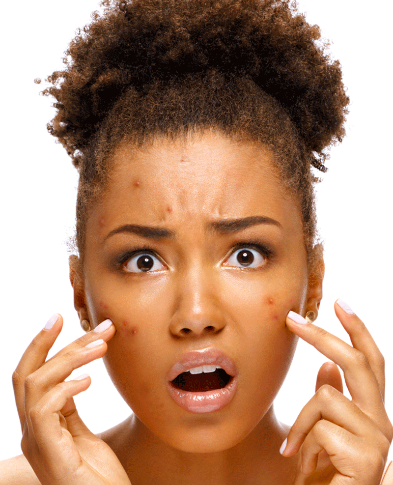 How Hair Affects Your Acne - Aesthetic Skin & Anti-aging Authority